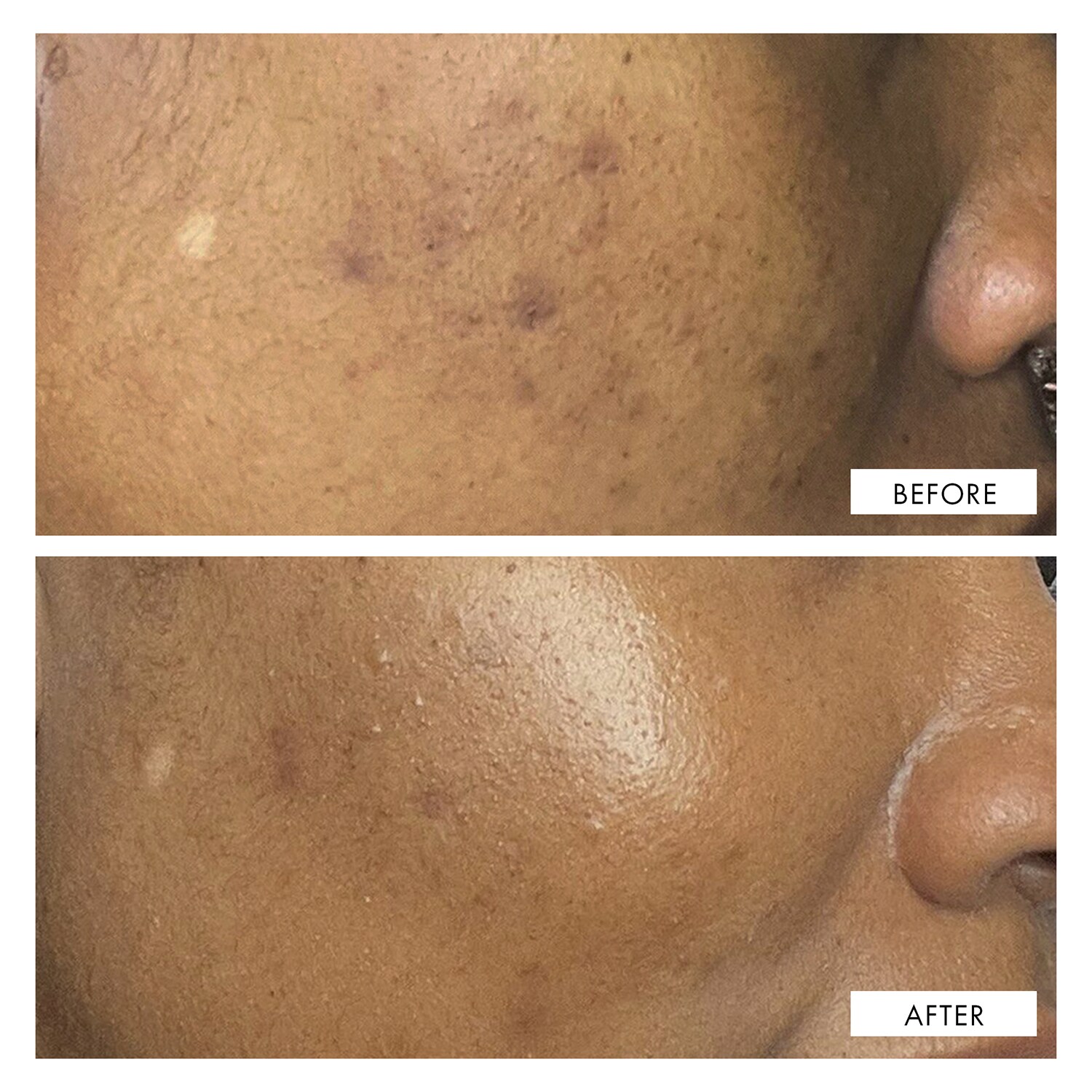 Dark Spot Correcting Serum - Sérum Corretor de Manchas Escuras 111Skin ≡ SEPHORA