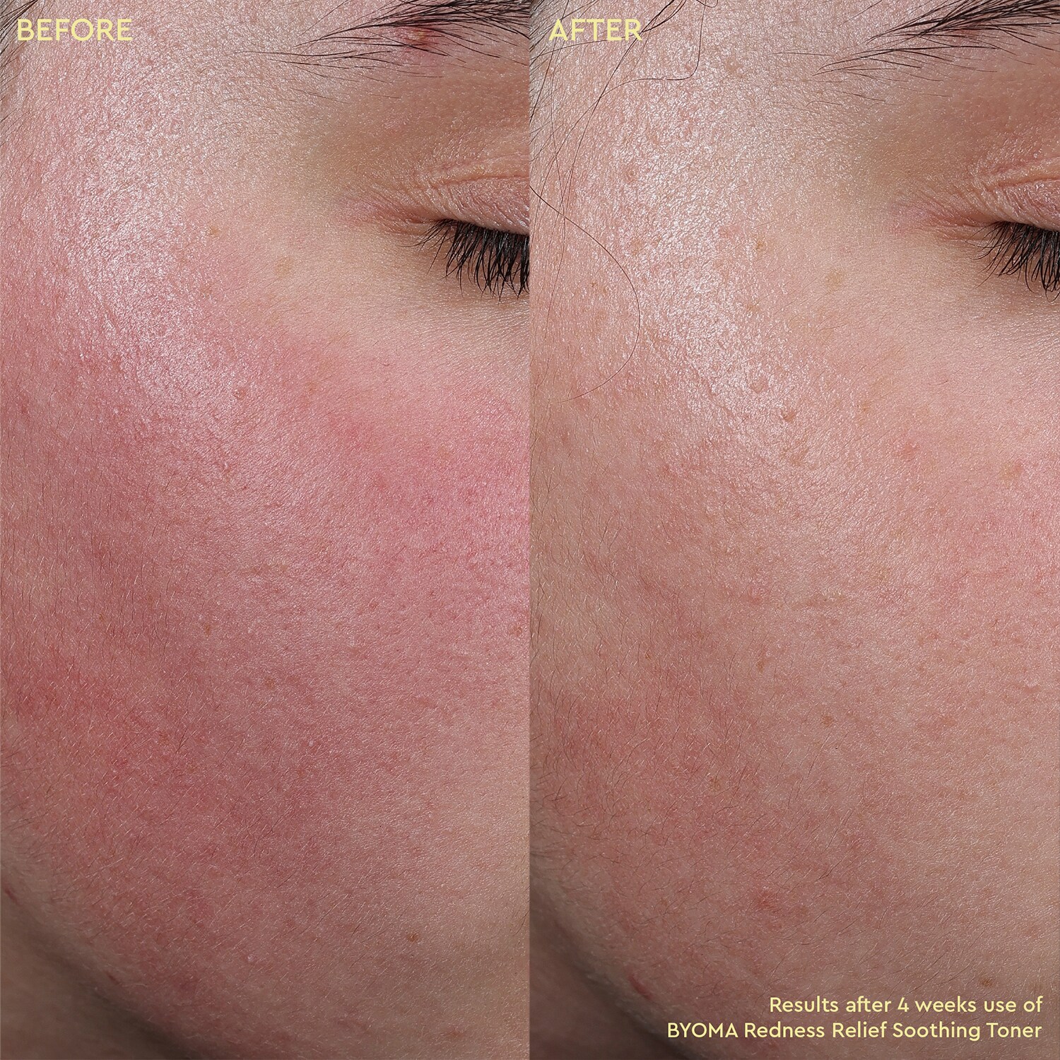 Redness Relief Soothing Toner- Tonique apaisant anti-rougeurs de BYOMA ...