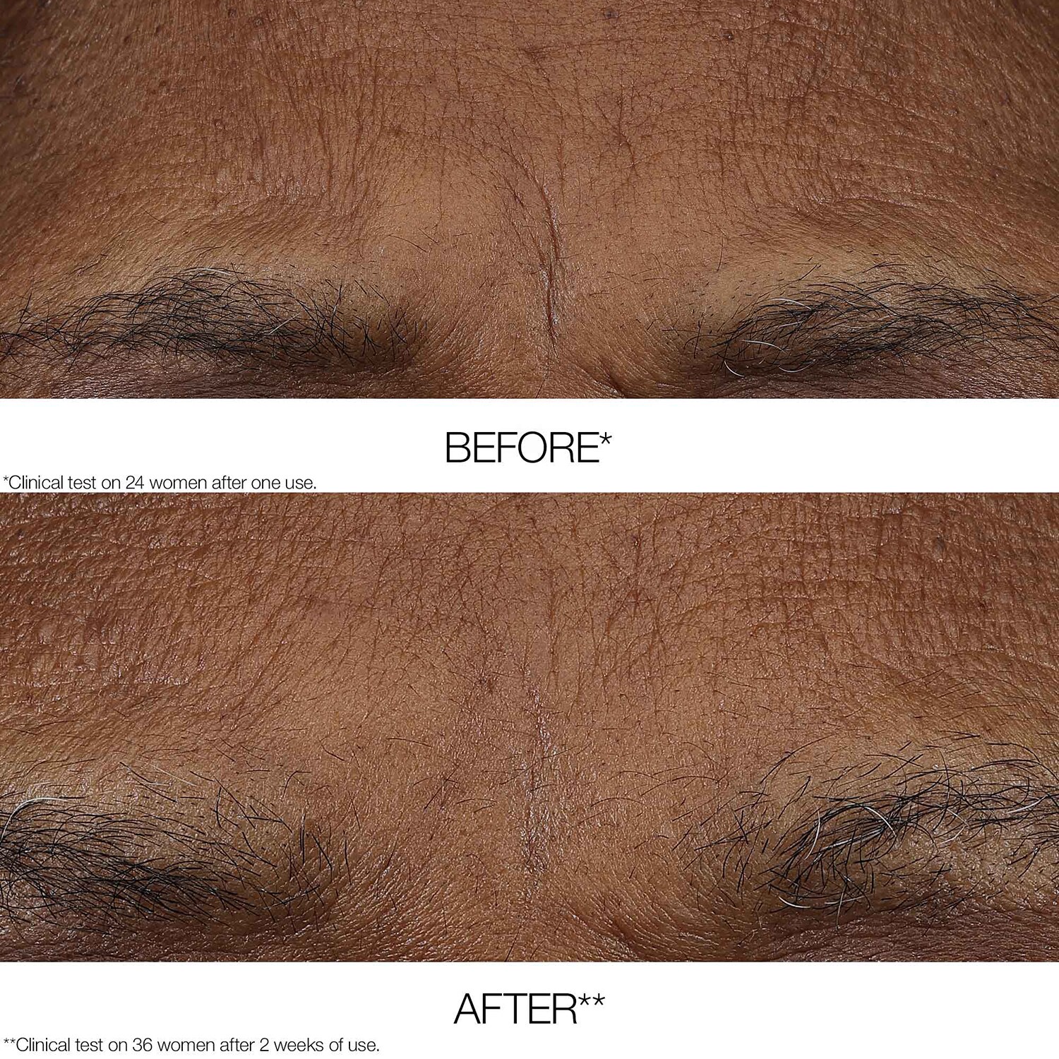 Smart Clinical Repair™ AM/PM Retinoid Balm - Sztyft do twarzy z ...