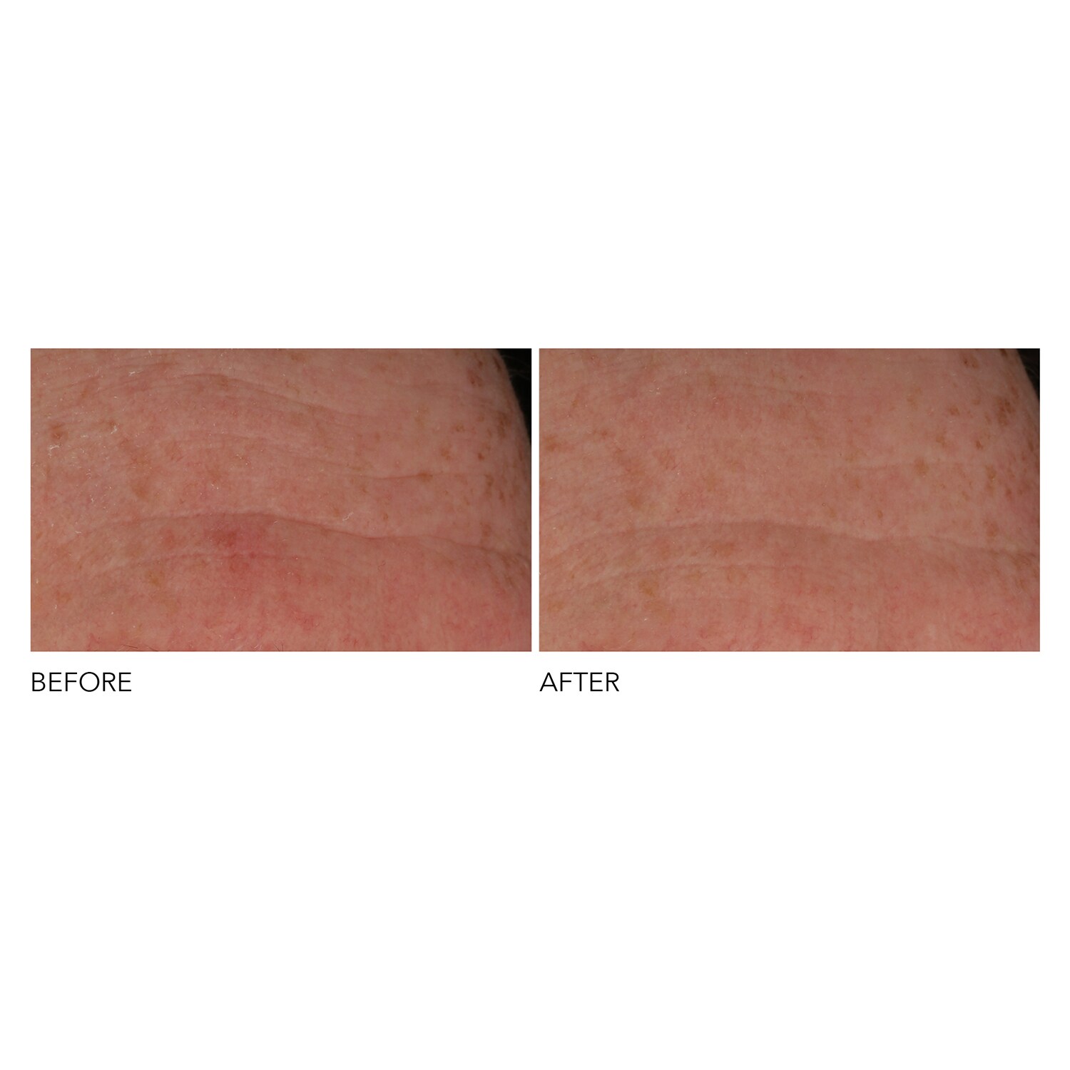Advanced Retinol + Ferulic - Tratamiento Concentrado Noche Antiarrugas ...
