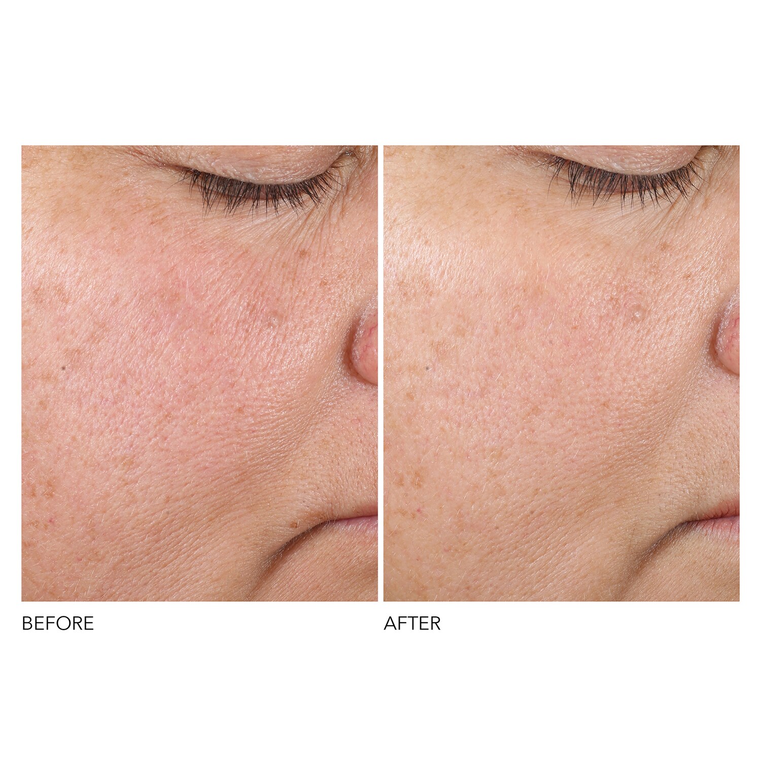 Advanced Retinol + Ferulic - Sérum Concentrado Redensificante de Dr ...