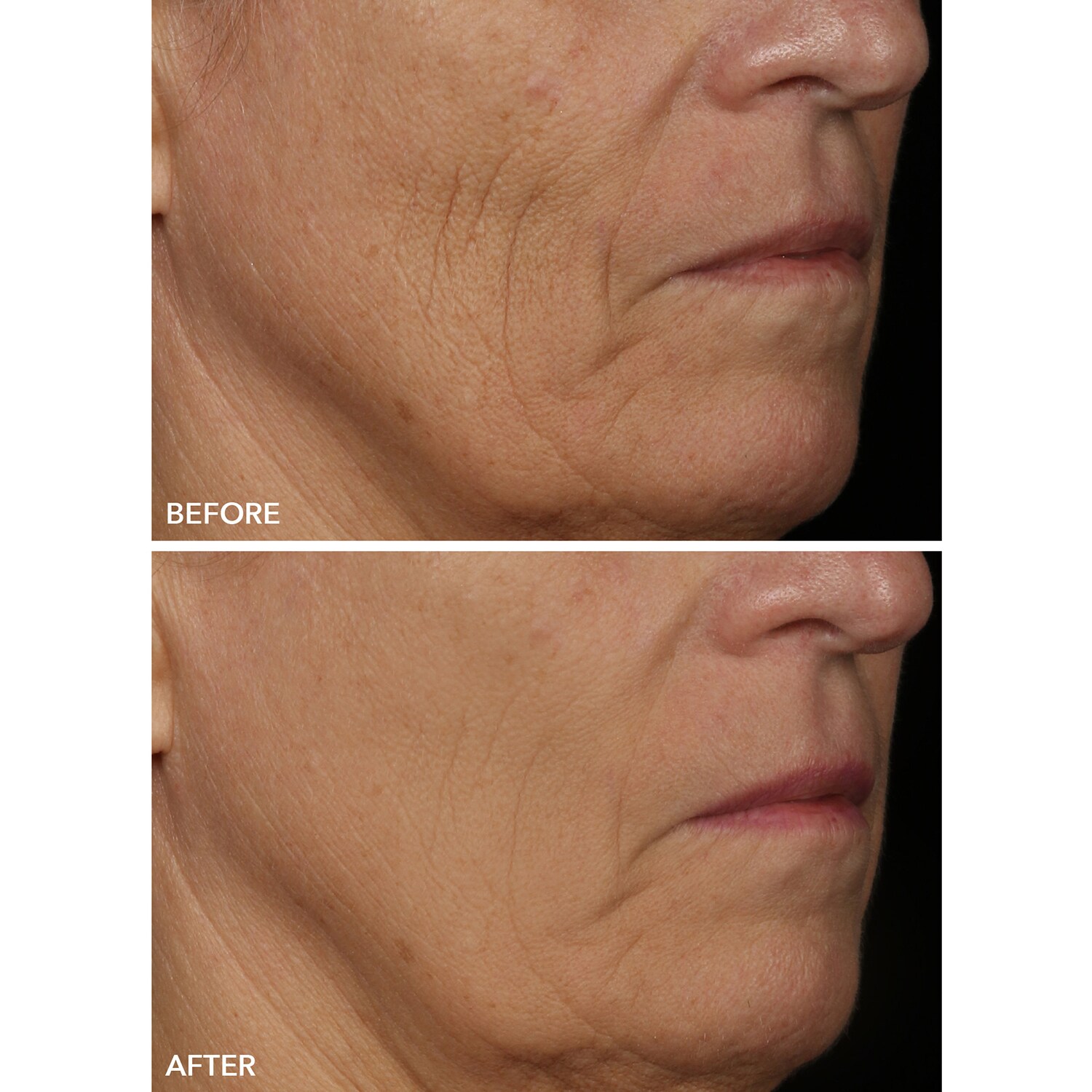 FaceWare Pro - LED-Gesichtsmaske von DR DENNIS GROSS ≡ SEPHORA