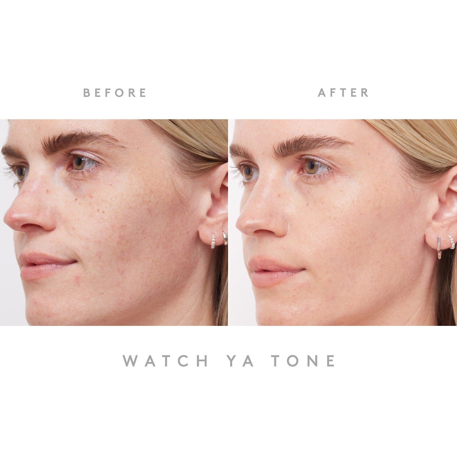 Watch Ya Tone - Niacinamide Dark Spot Serum Fenty Skin ≡ SEPHORA