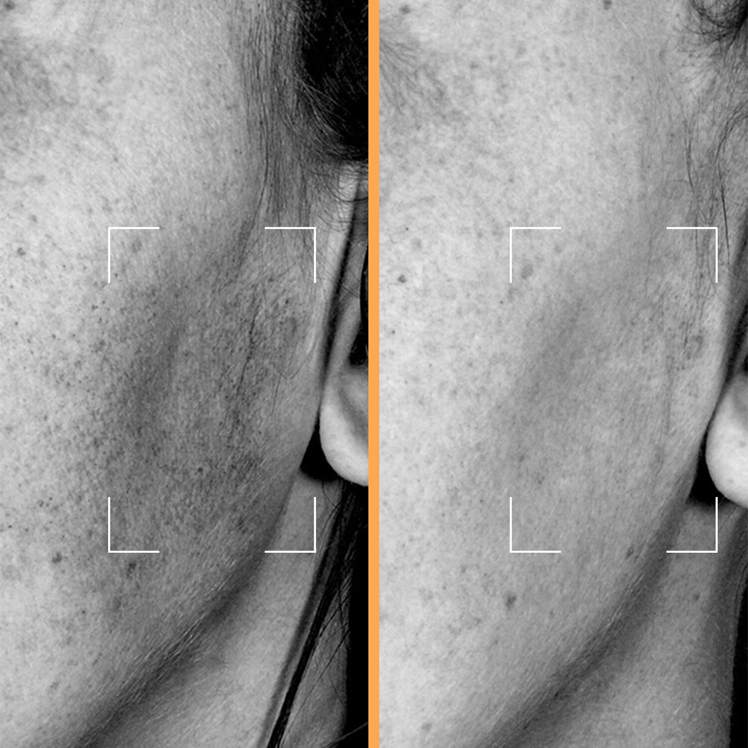 Cápsulas Brightening - Sérum luminoso rico em Niacinamida e ...