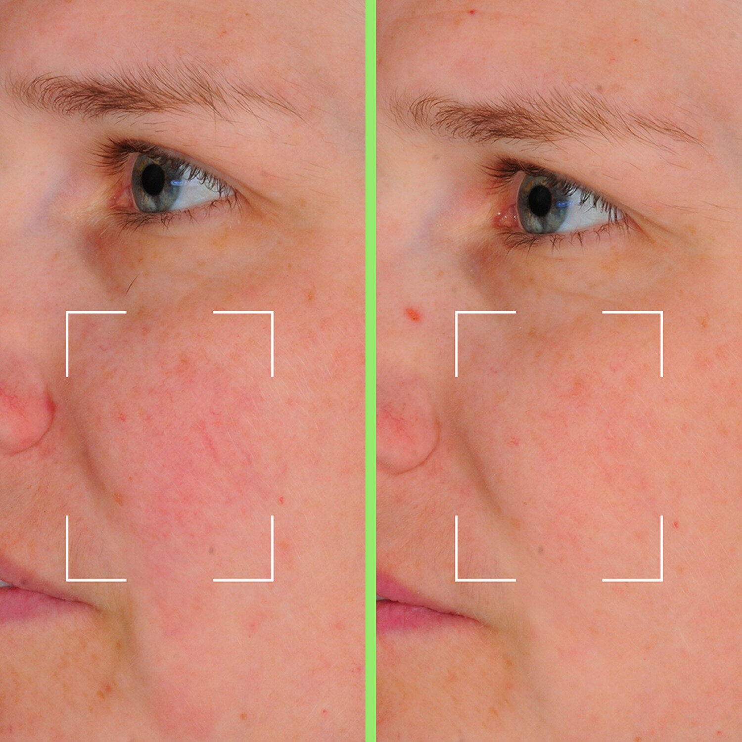 Capsule Skin Perfect - Siero perfezionante con Niacinamide, HA e Vit. C ...