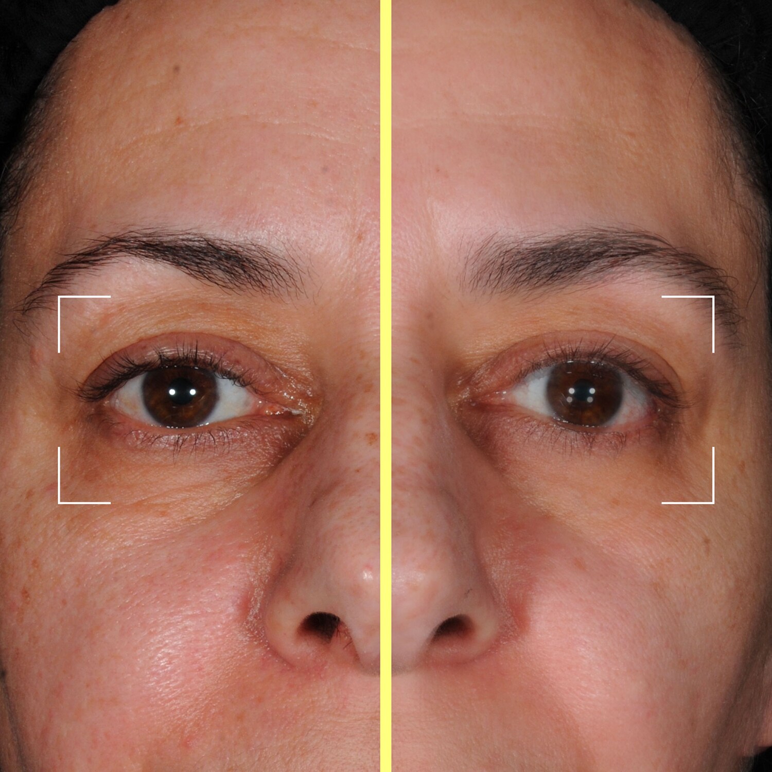 Capsule Eye - Siero occhi con Peptidi, Caffeina e Niacinamide di ...