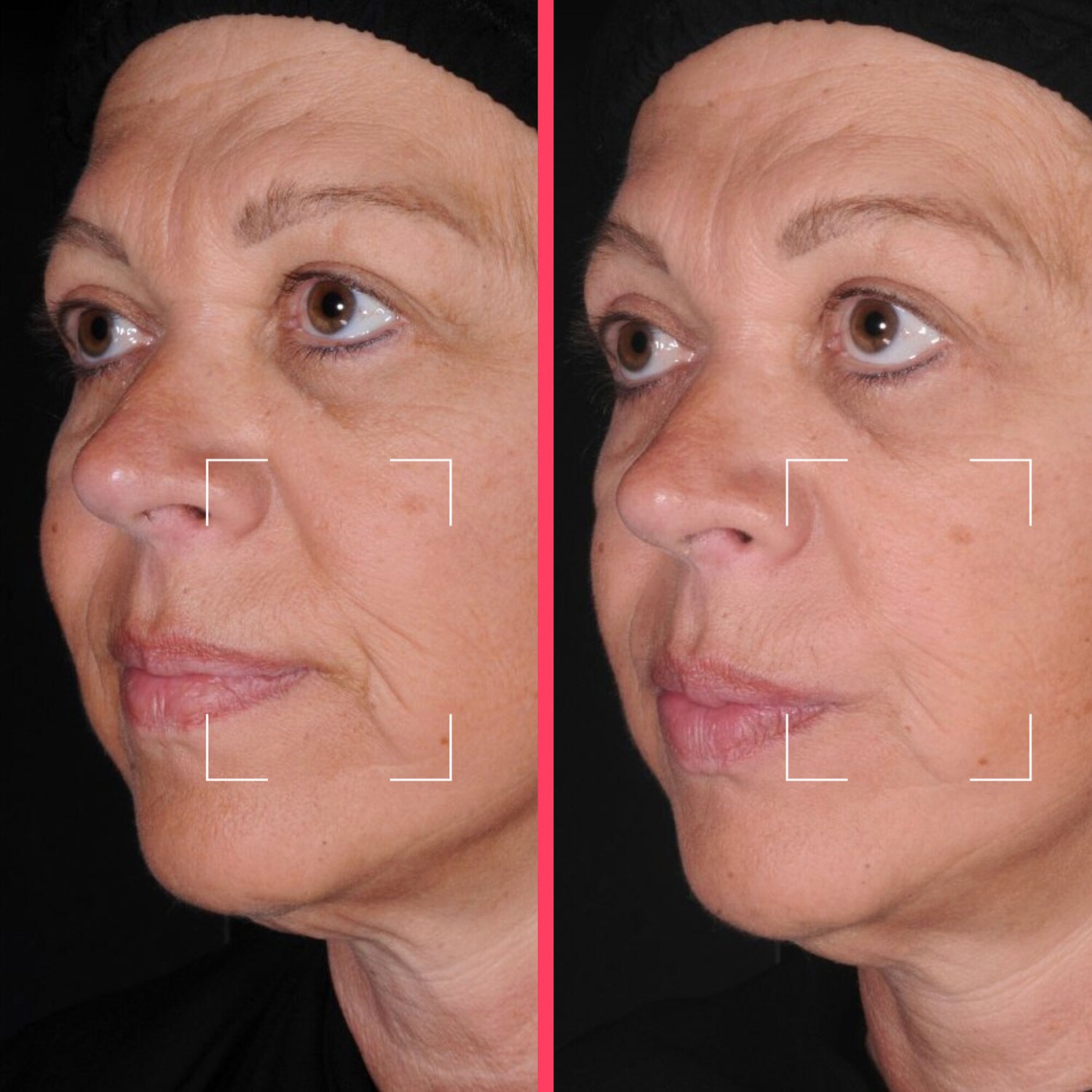 Capsule Lift - Siero rassodante con Niacinamide, Peptide e HA di ...