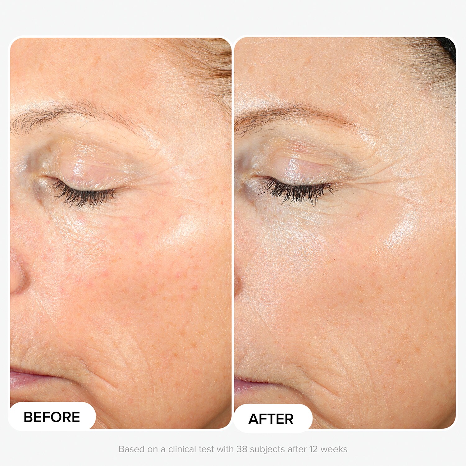 Boost - Booster 15% Vitamine C de PAULA'S CHOICE ≡ SEPHORA