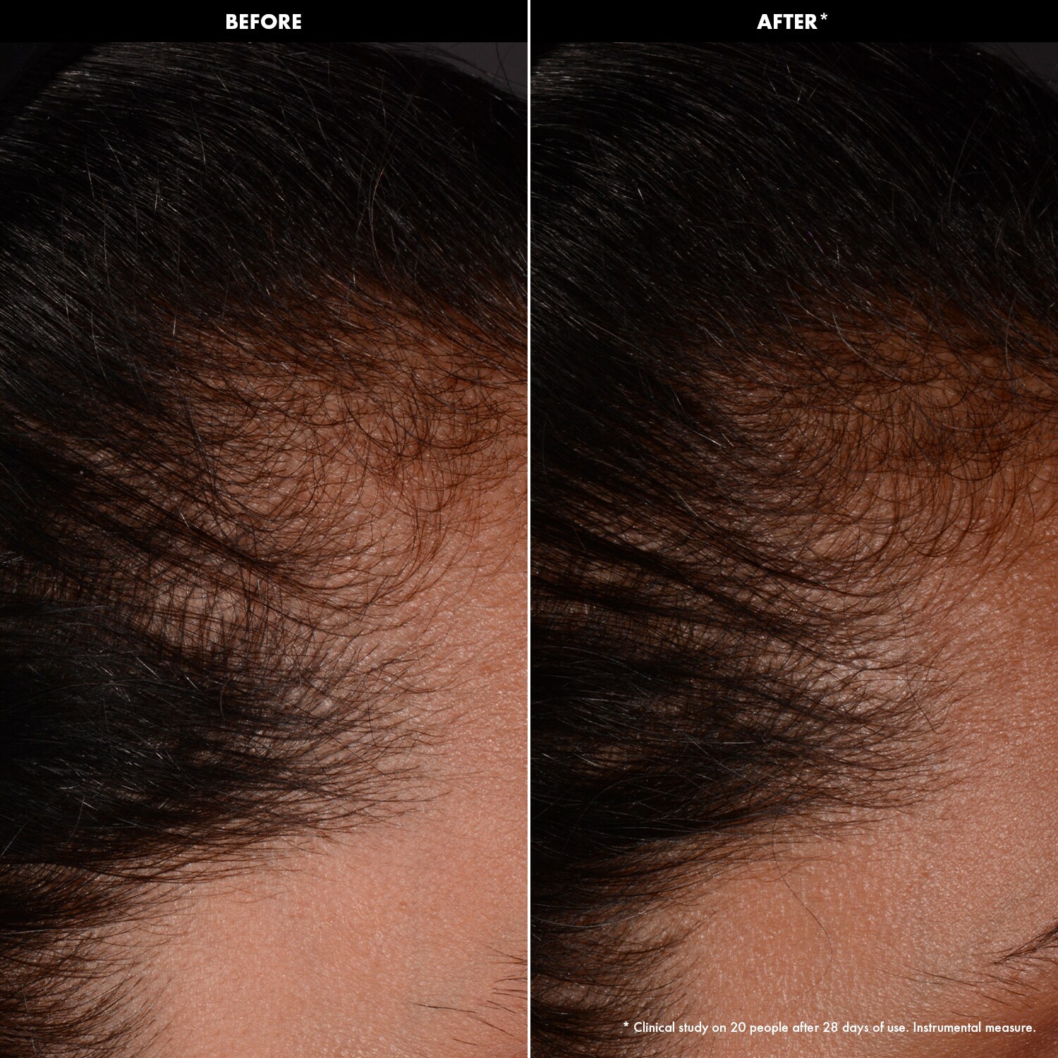 Siero Rafforzante e Infoltente - Siero per il Cuoio Capelluto di ...