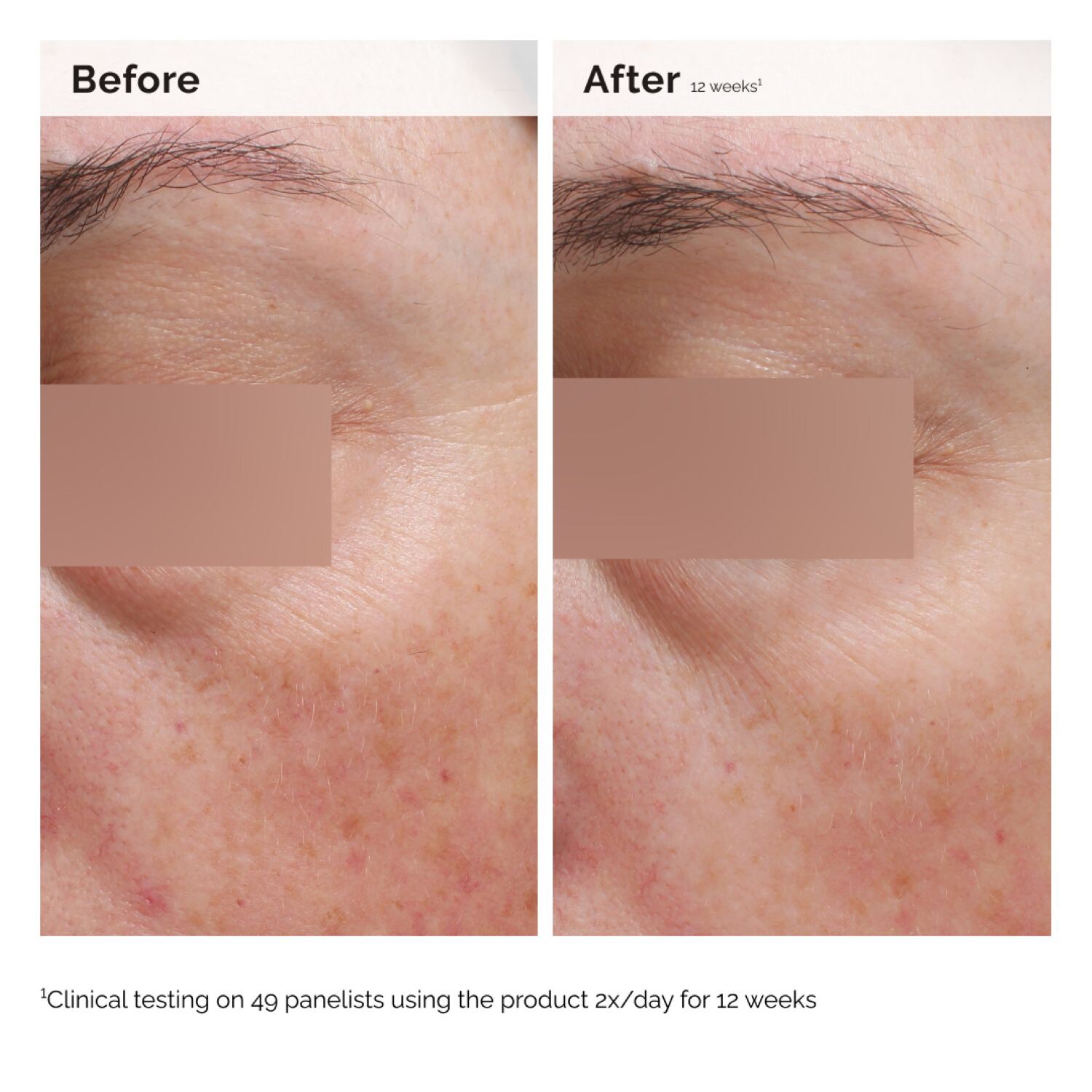 The Ordinary - Face And Body Emulsion Niacinamide 5% - Leichte Emulsion