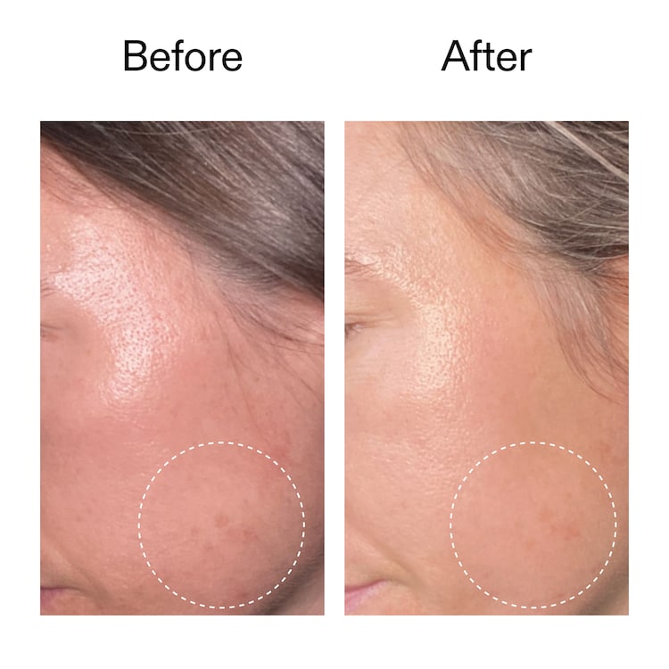 Advanced Retinal Serum - Sérum de retinol Avançado | The Inkey List ≡ ...