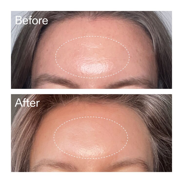 Advanced Retinal Serum - Sérum de retinol Avançado | The Inkey List ≡ ...
