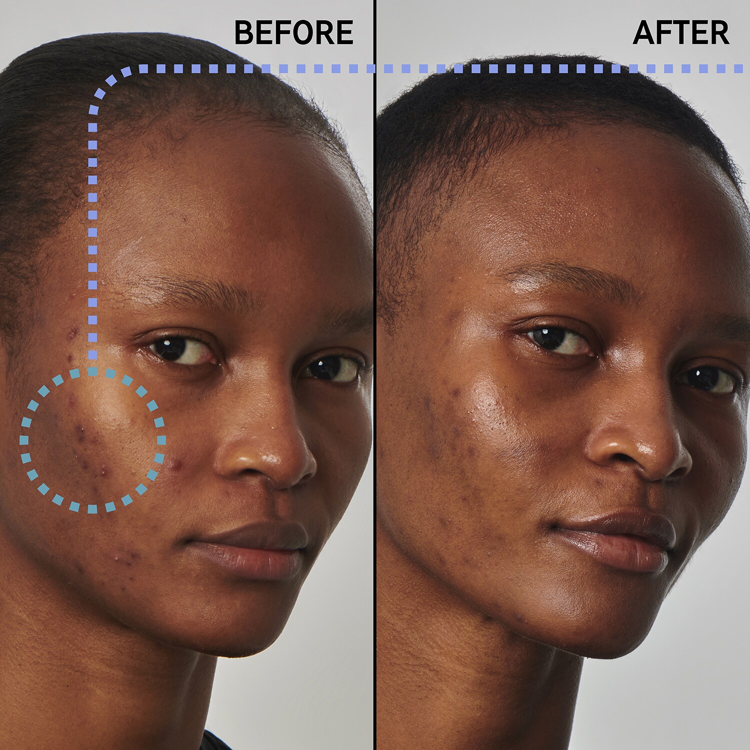 Solution contre l'excès de sébum avec du niacinamide 20 % - Sérum ...