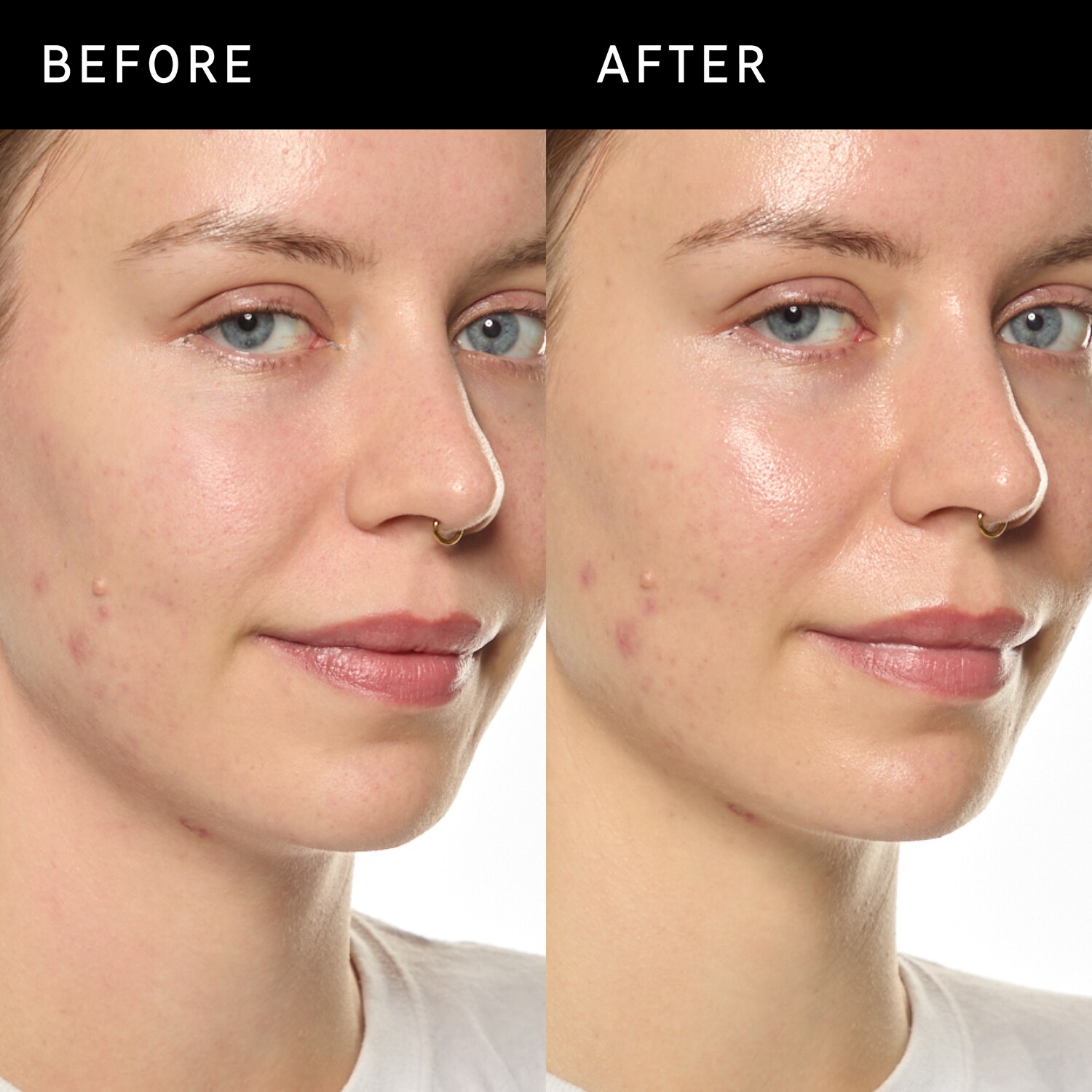 Ectoin Hydro-Barrier Serum - Sérum Hidratante e Protetor The Inkey List ...